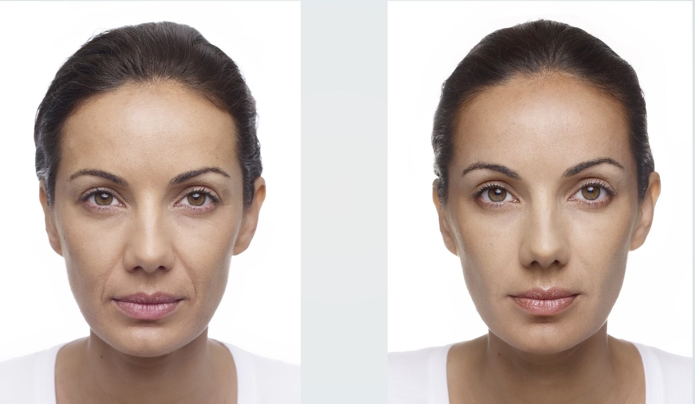 Comment est le visage avant et après l'arrêt du tabac (2024)